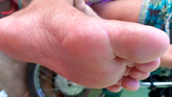 Kit Podol 3 Aplicações (Amolecedor + Hidratante + Espátula)