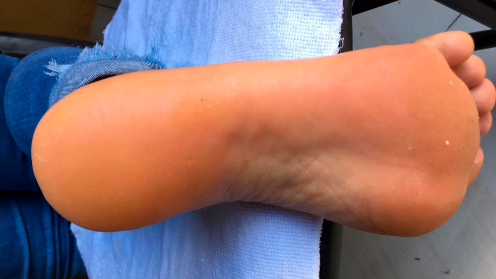 Kit Podol 3 Aplicações (Amolecedor + Hidratante + Espátula)