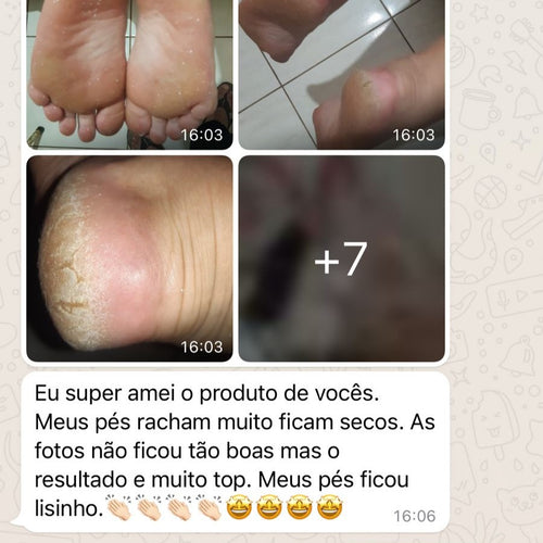 Kit Podol Nano Creme Hidratante (Leve 3, Pague 2) | Foot's